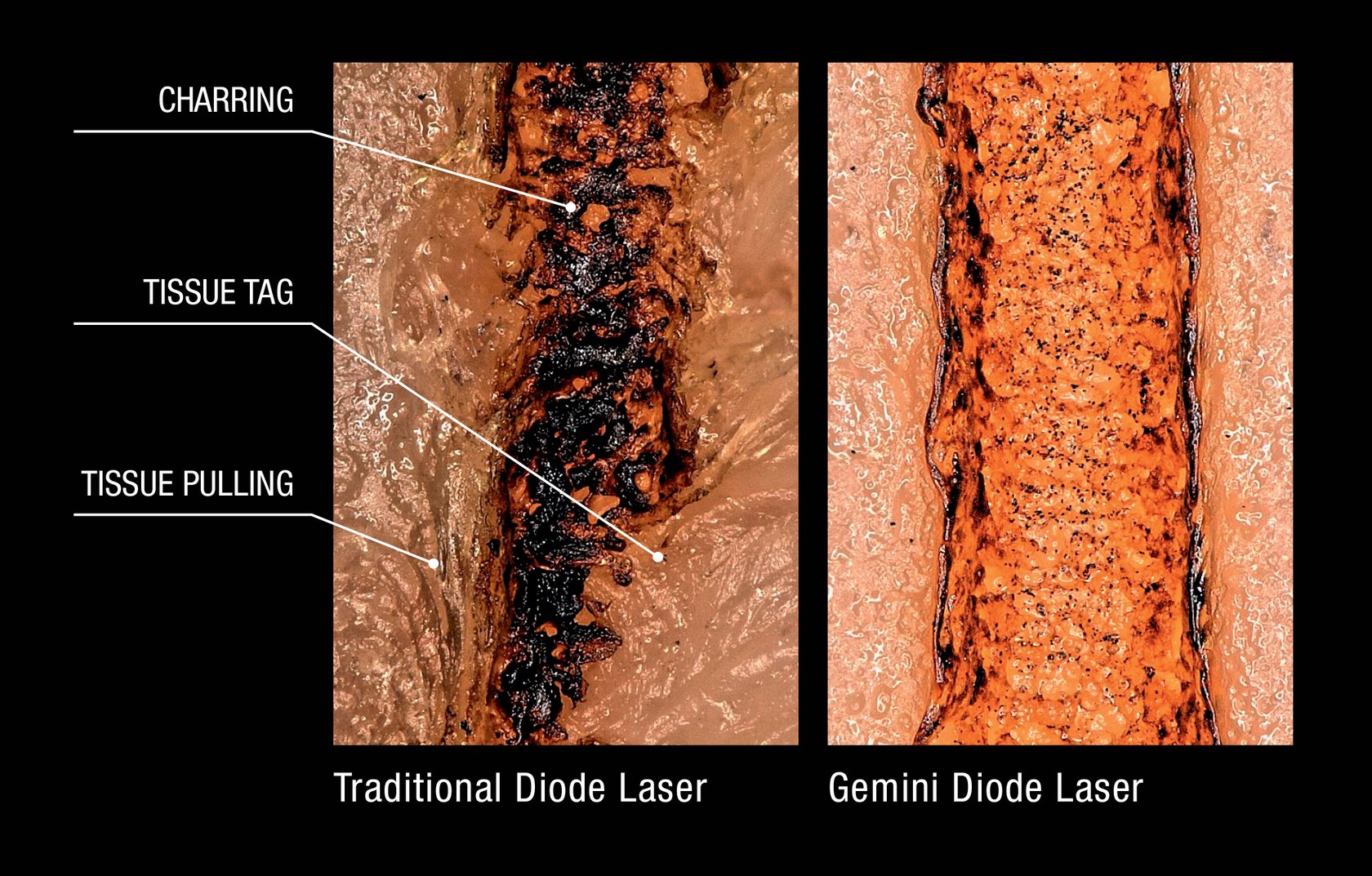 Your Guide to Buying a Soft-Tissue Dental Laser